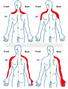 Neck Pain Management - A Comprehensive View Of Managing Neck Pain
