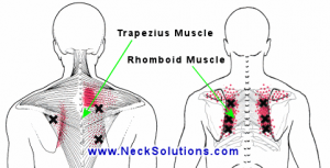 Pain Between Shoulder Blades - Causes & Treatments