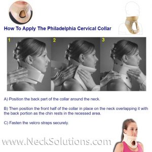Philadelphia Collar - Philadelphia Cervical Support Collar