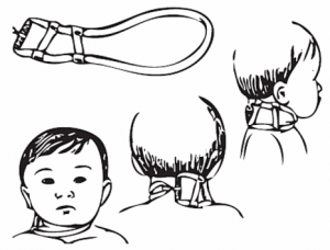 Tot Collar - Torticollis Treatment: Infants, Children & Adults