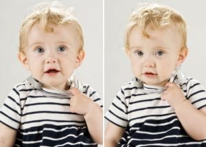 Tot Collar - Torticollis Treatment: Infants, Children & Adults