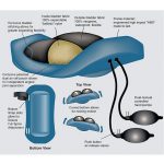 Back Traction - Home Lumbar Spine Decompression Devices