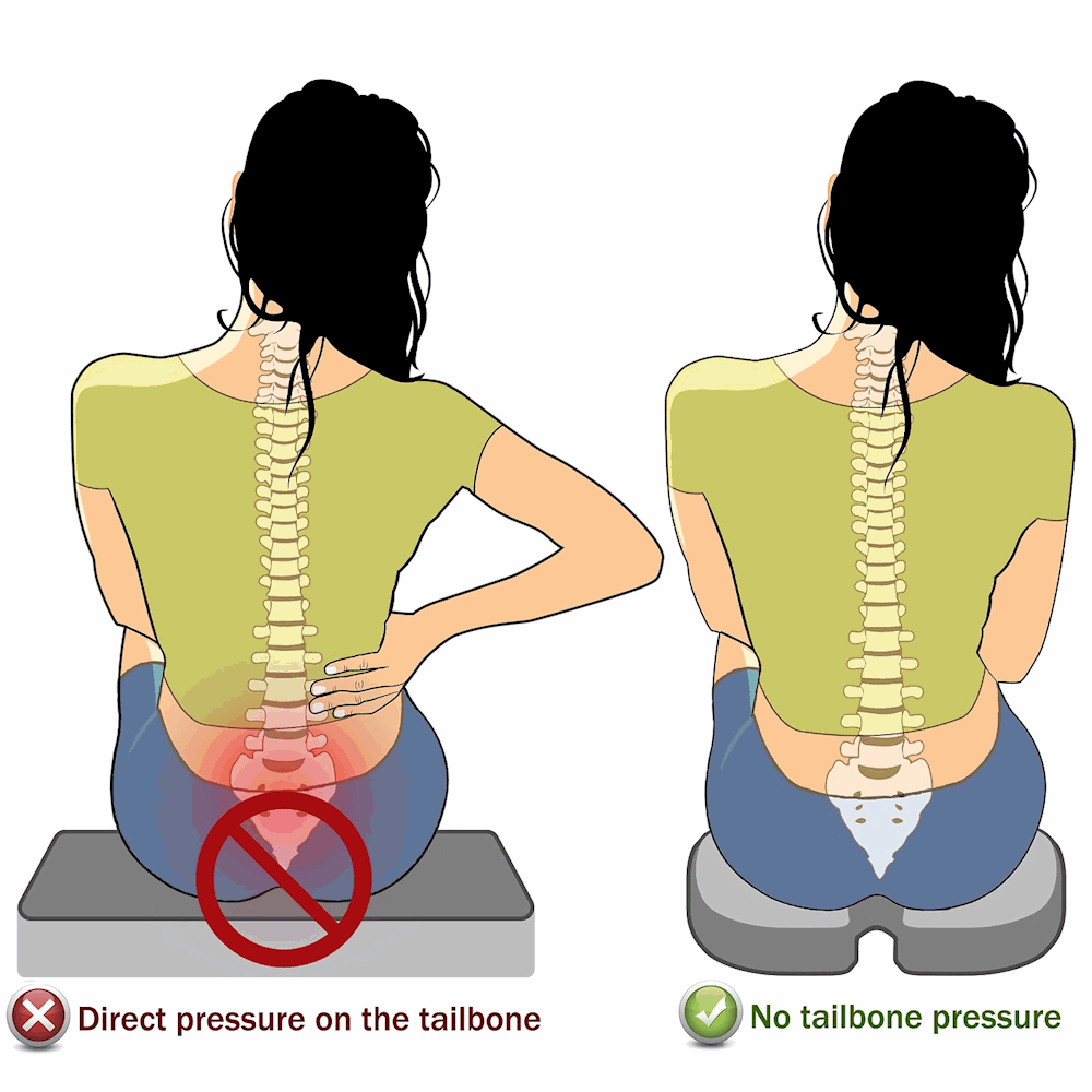 Tailbone Pain Causes Treatment For Coccyx Tailbone Pain Causes Treatment For Coccyx