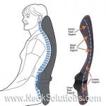 Schmorl's Nodes - Causes, Symptoms, & Treatment