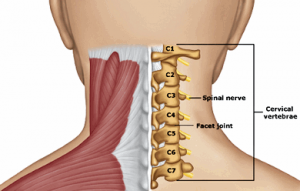 Neck Spasms - Common Causes & Treatment