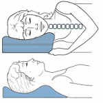 Military Neck - What Is It? Should It Be Corrected? & How To Fix It