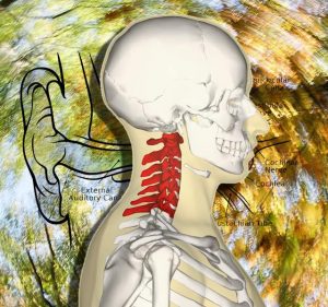 Dizziness - Neck Related Vertigo Caused By The Cervical Spine
