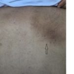 Upper Back Pain Causes & Seeking Pain Releif Solutions