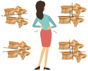 Lumbar Instability - Common Cause OF Chronic Pain