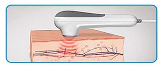 Ultrasound Therapy For Pain Relief & Healing