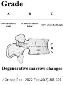 Modic Changes - Spinal Disease Or Normal Finding?